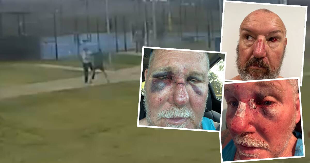 Guards Walk Off Job After ‘Slap on the Wrist’ Sentence for Attacker