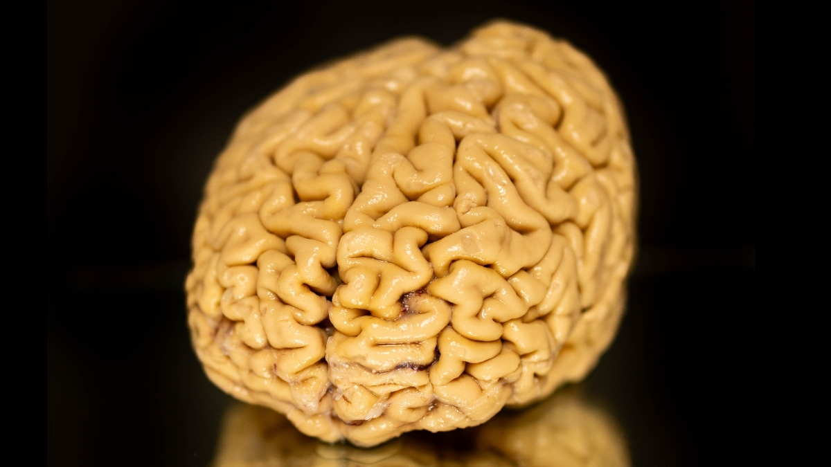 Study Unveils Secrets Behind 'Superagers' and Their Resilient Brains