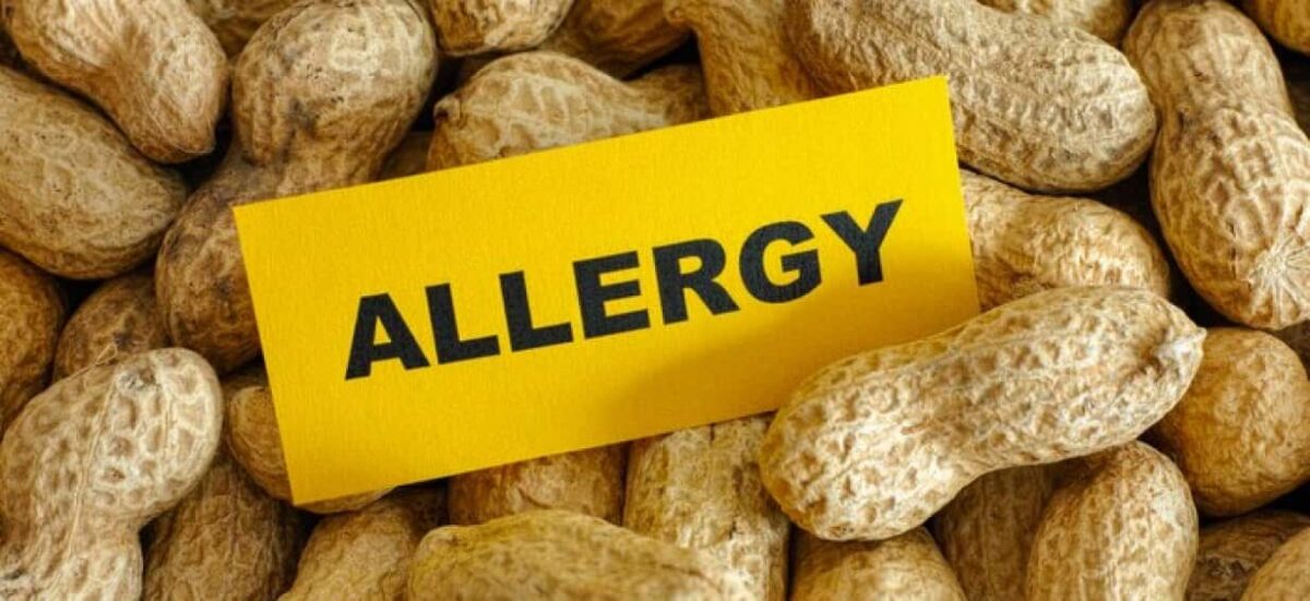 Early Peanut Exposure Prevents Thousands from Developing Allergies